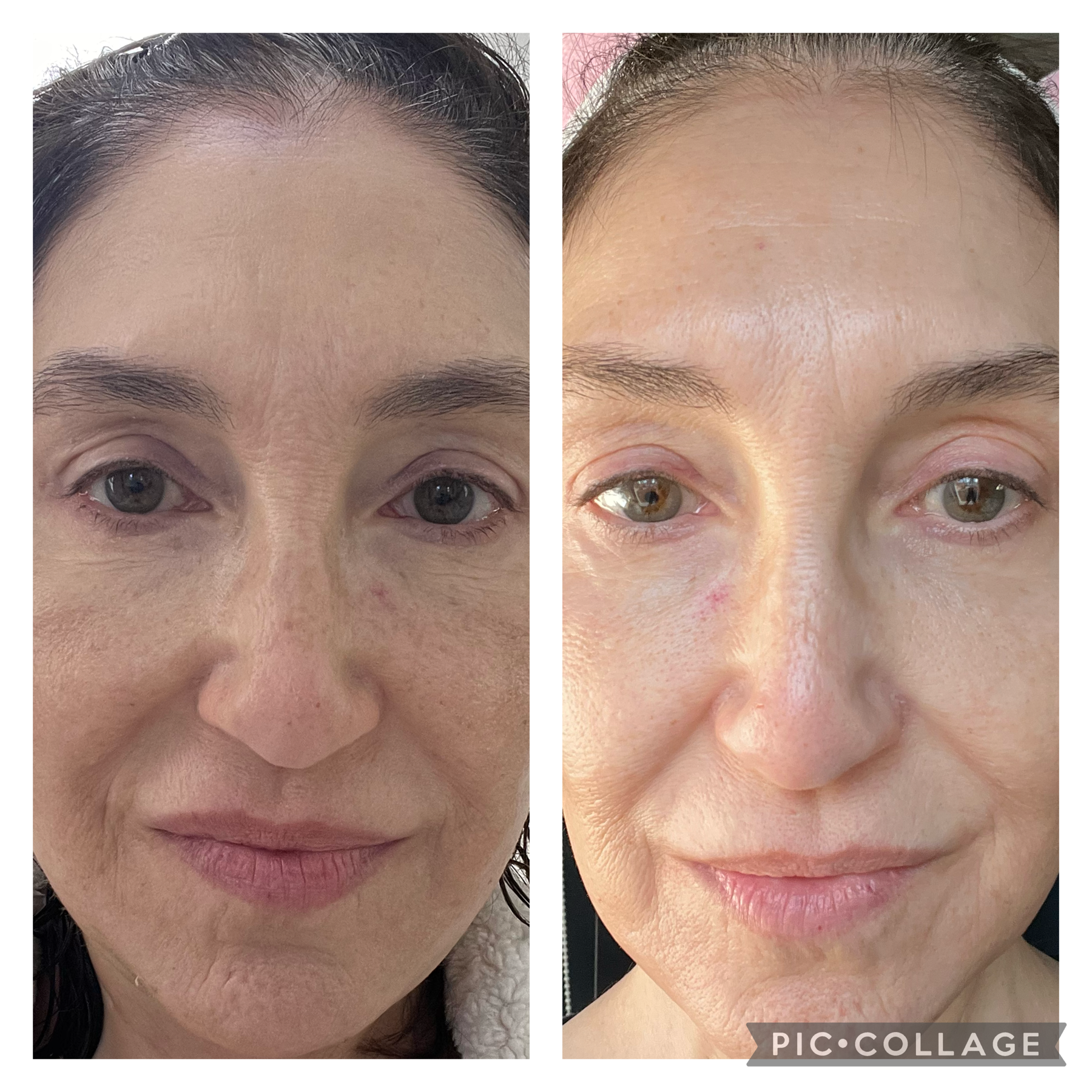 An Agency Skincare Review. 5 Very Compelling Reasons to Give It a Try ...