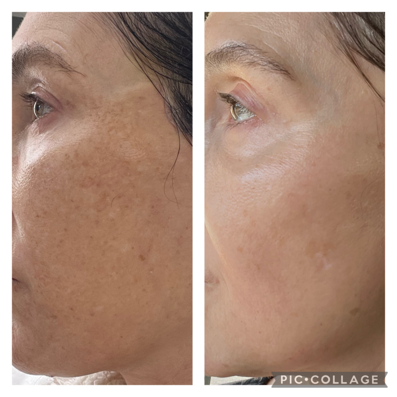 An Agency Skincare Review. 5 Very Compelling Reasons to Give It a Try ...